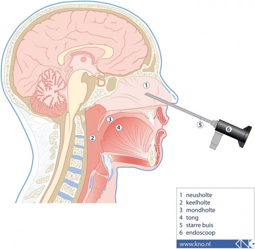 Neusendoscopie - Keel-Neus-Oorheelkunde en Heelkunde van het Hoofd ...