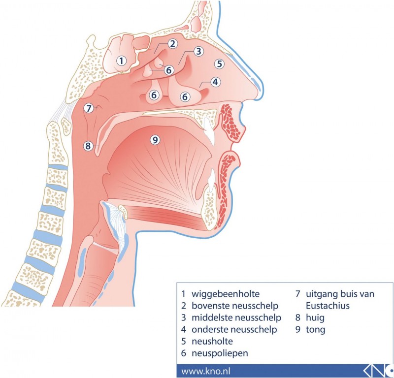Neuspoliepen - Keel-Neus-Oorheelkunde en Heelkunde van het Hoofd-Halsgebied