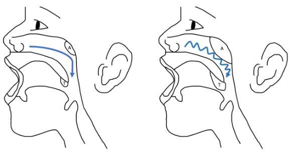 Snurken en obstructief slaapapneu bij kinderen
